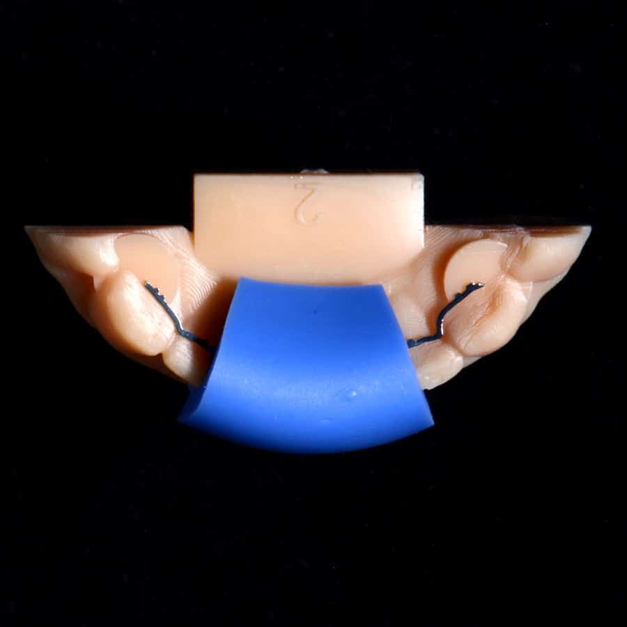 Retainer | Gerade Zähne - ein Leben lang | Kieferorthopädie